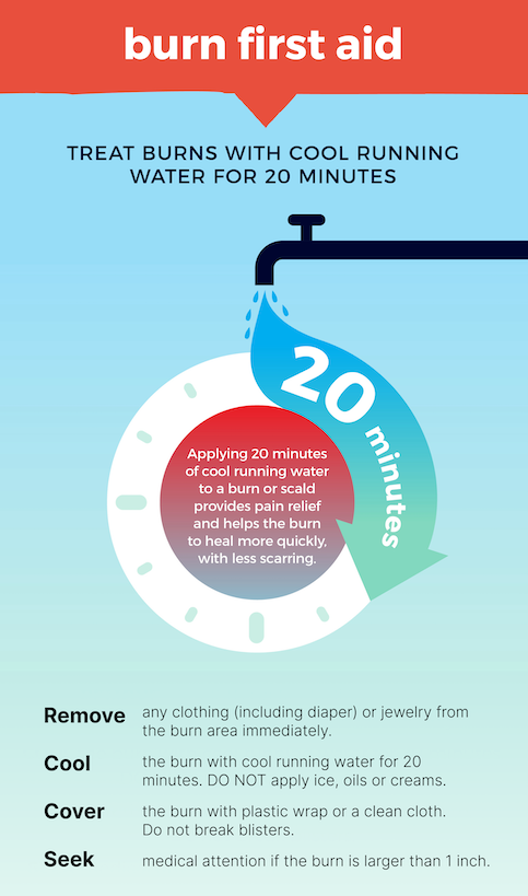 Apply Cold Water Directly To Burned Area